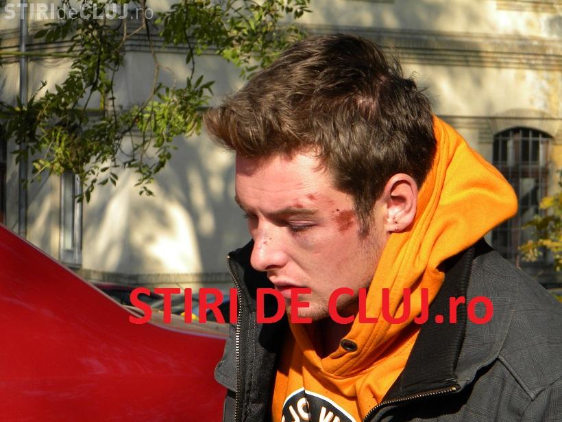 Un student acuza ca politistii din Cluj l-au batut cu bestialitate in ...